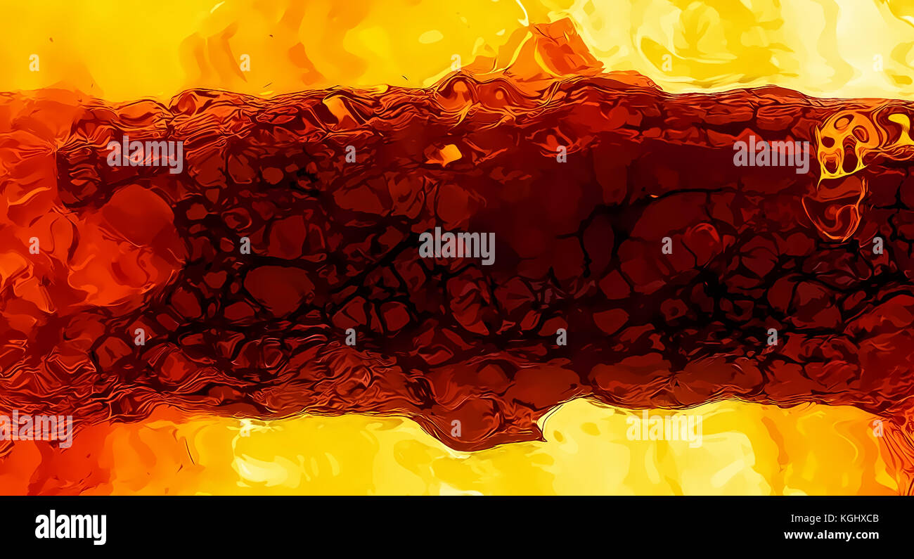 abstract background graphic, burning fire and flame structures Stock ...