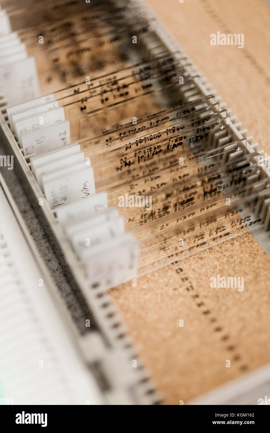 Various medical samples on microscope slides in box at laboratory Stock ...