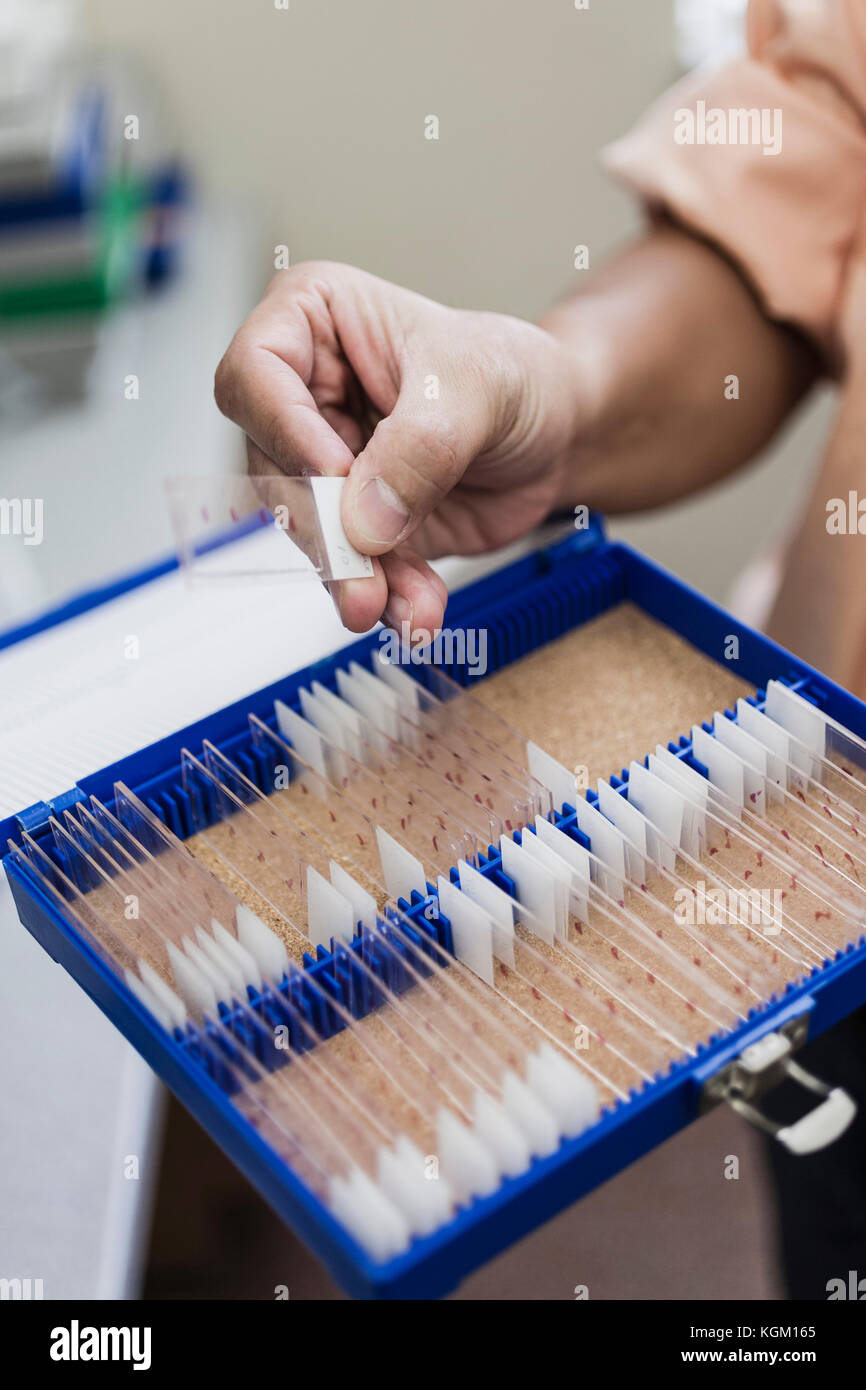 Blood on slide hi-res stock photography and images - Alamy