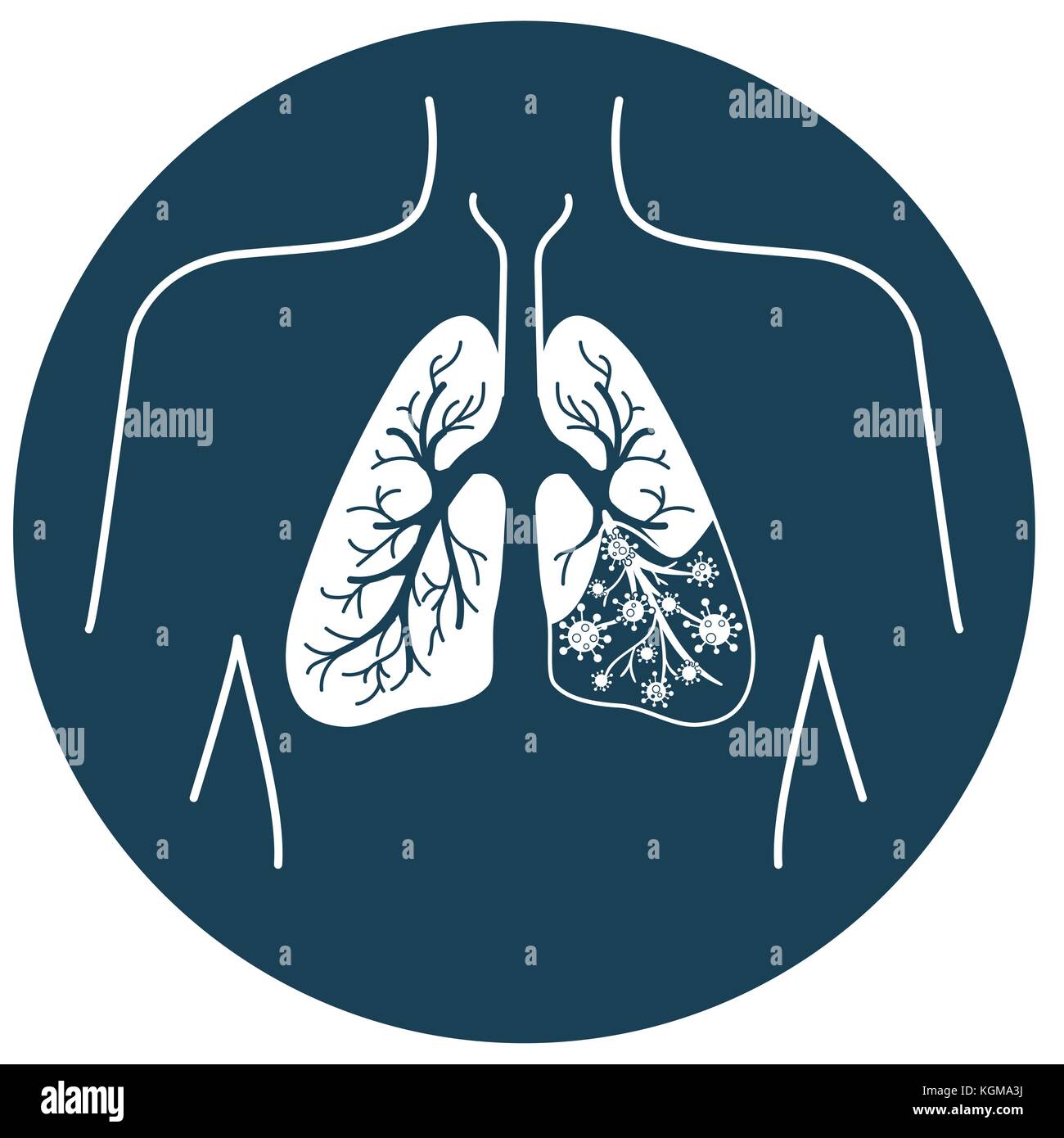Icon Of Lung Disease Pneumonia Asthma Cancer In The Form Of Lung