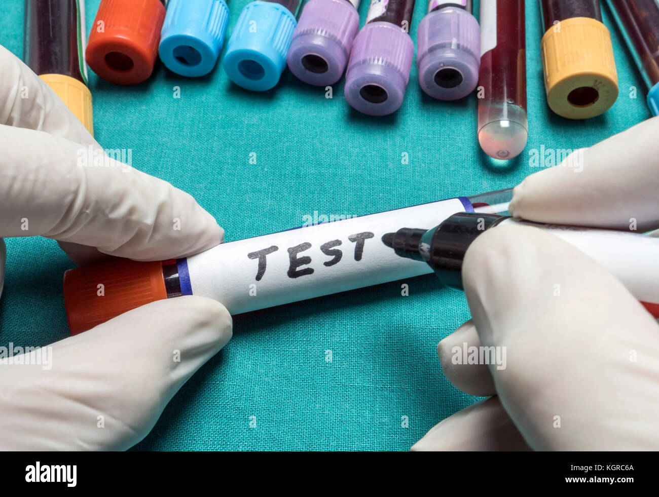 Red blood samples analysis hi-res stock photography and images - Alamy