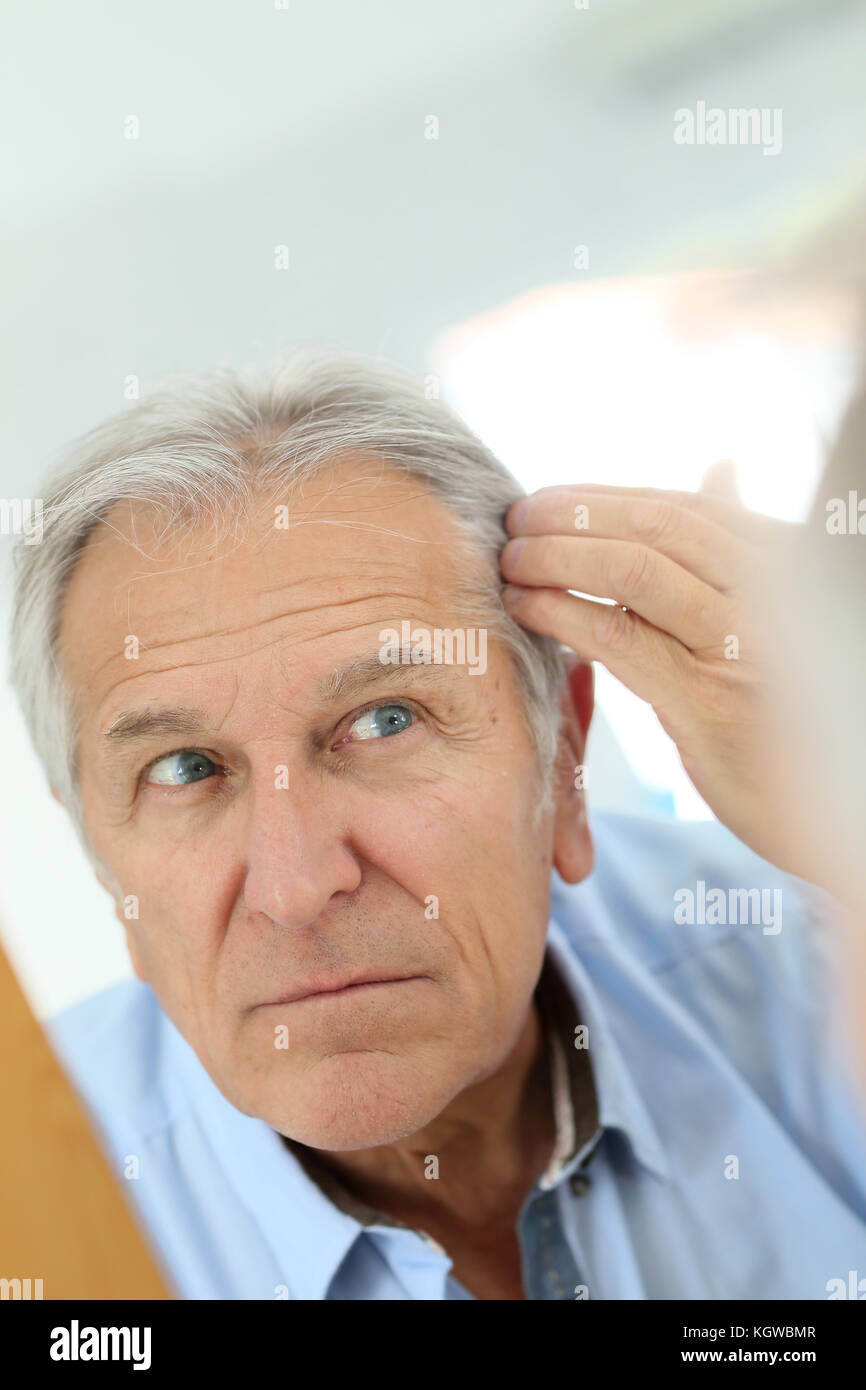 Senior man concerned by hair loss Stock Photo - Alamy