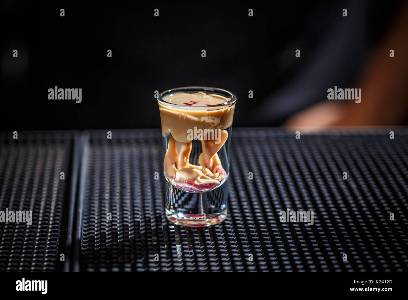 Brain hemorrhage shot hi-res stock photography and images - Alamy