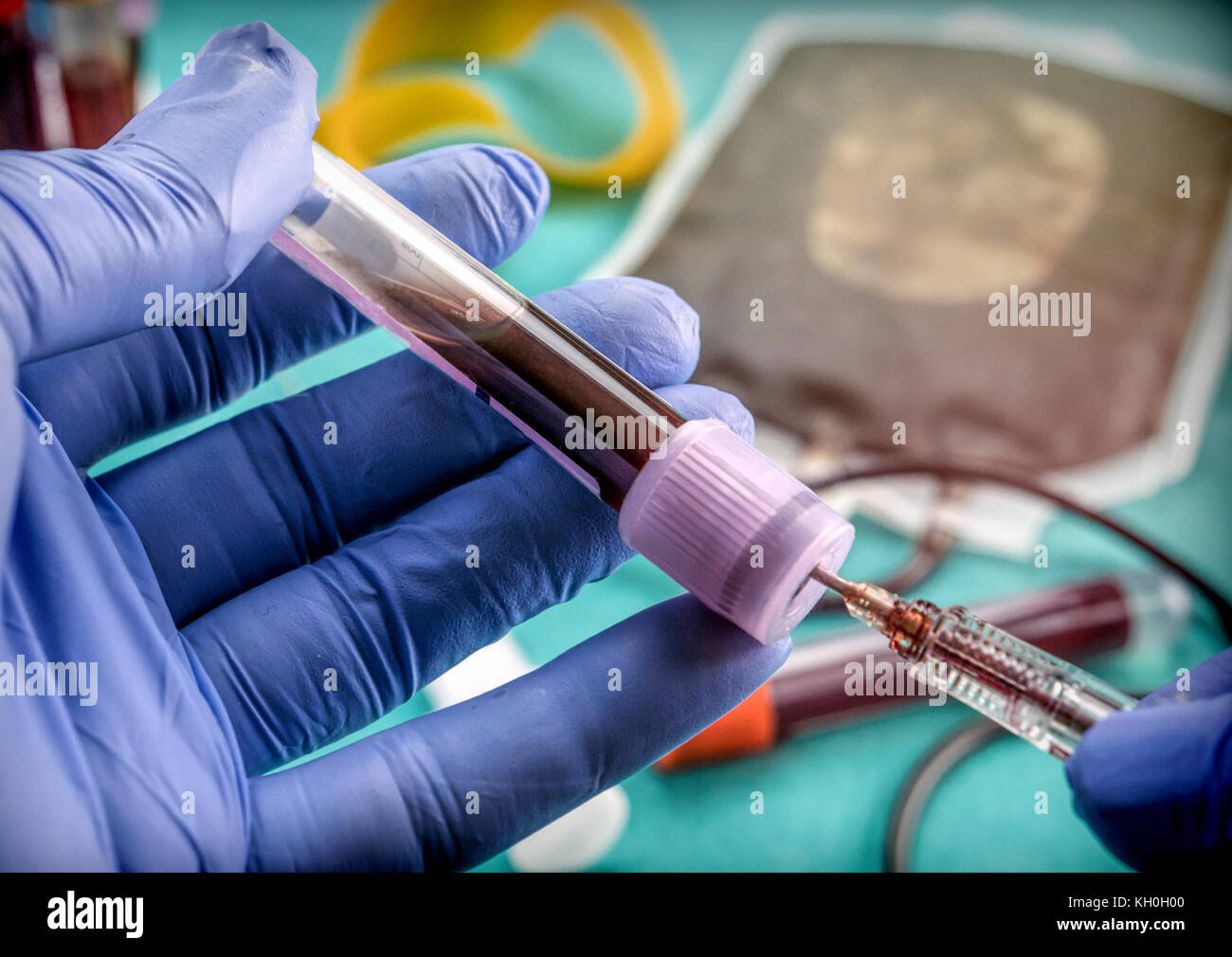 Medical procedure test hi-res stock photography and images - Alamy
