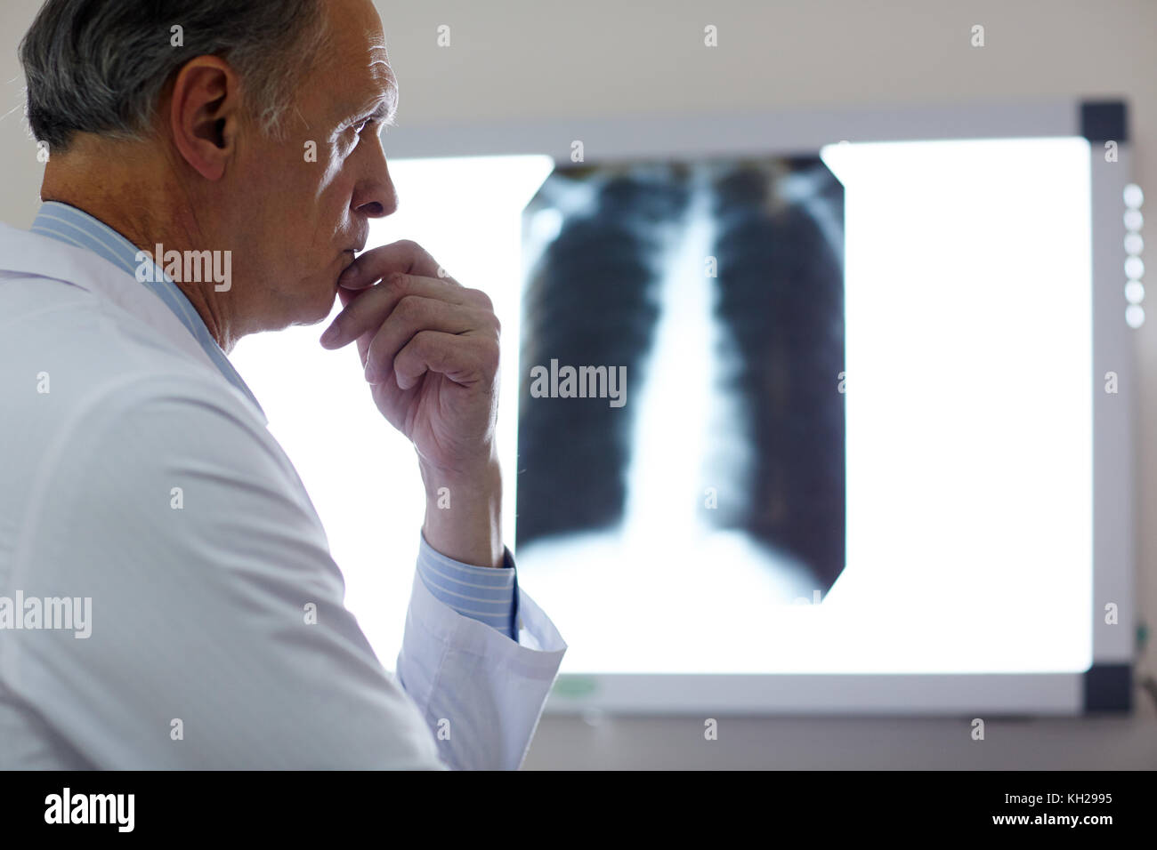 Pensive radiologist keeping his hand by chin with x-ray image on ...