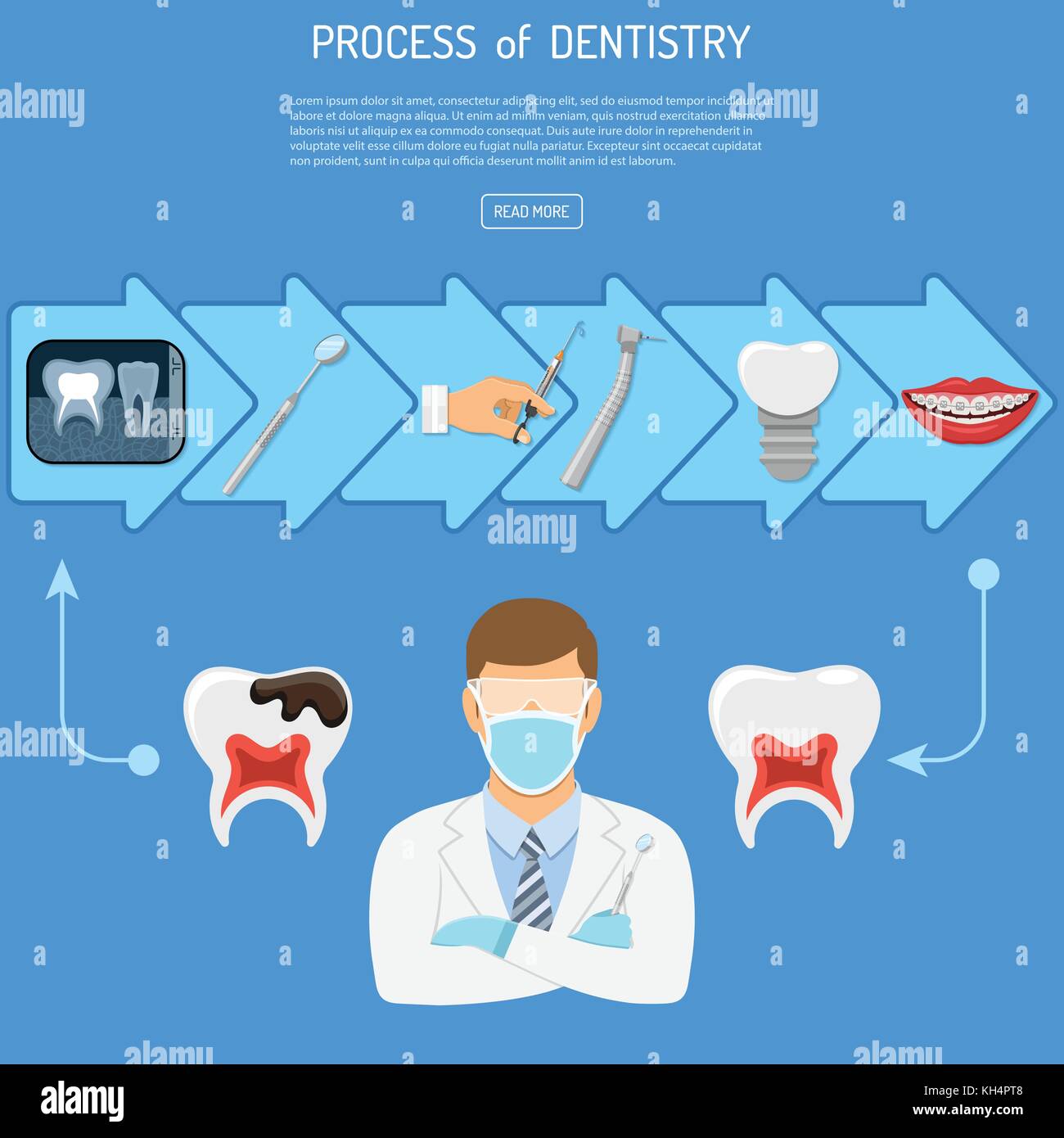 Process of Dentistry Concept Stock Vector Image & Art - Alamy