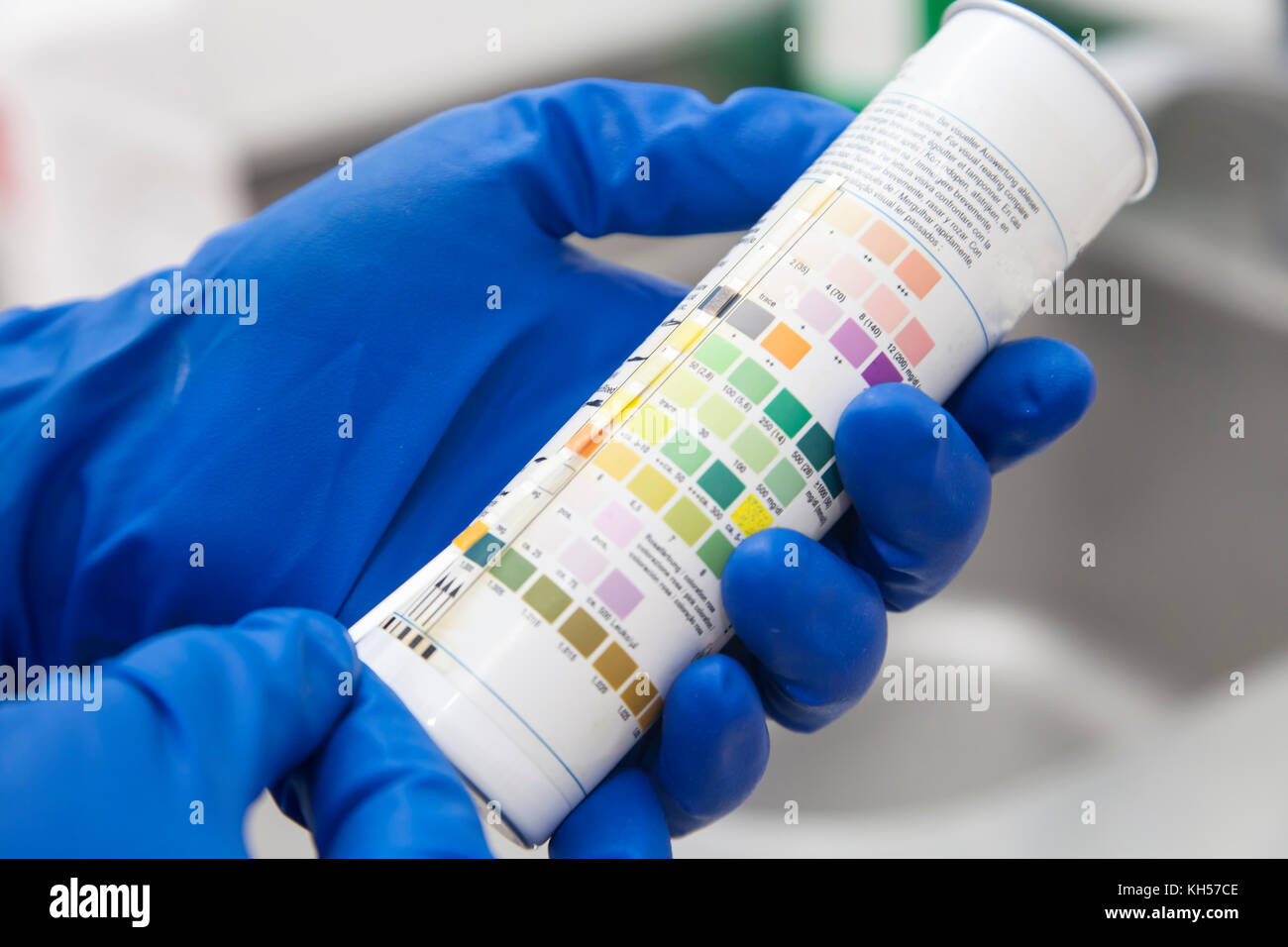 Practioner measuring pH test strips of urine sample Stock Photo - Alamy