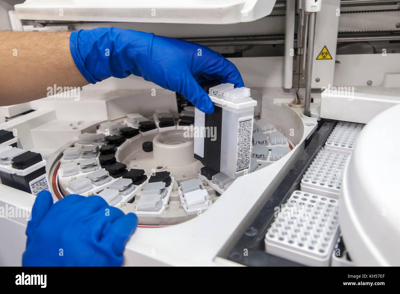 Practioner installing new test tubes to machine for blood tests in ...