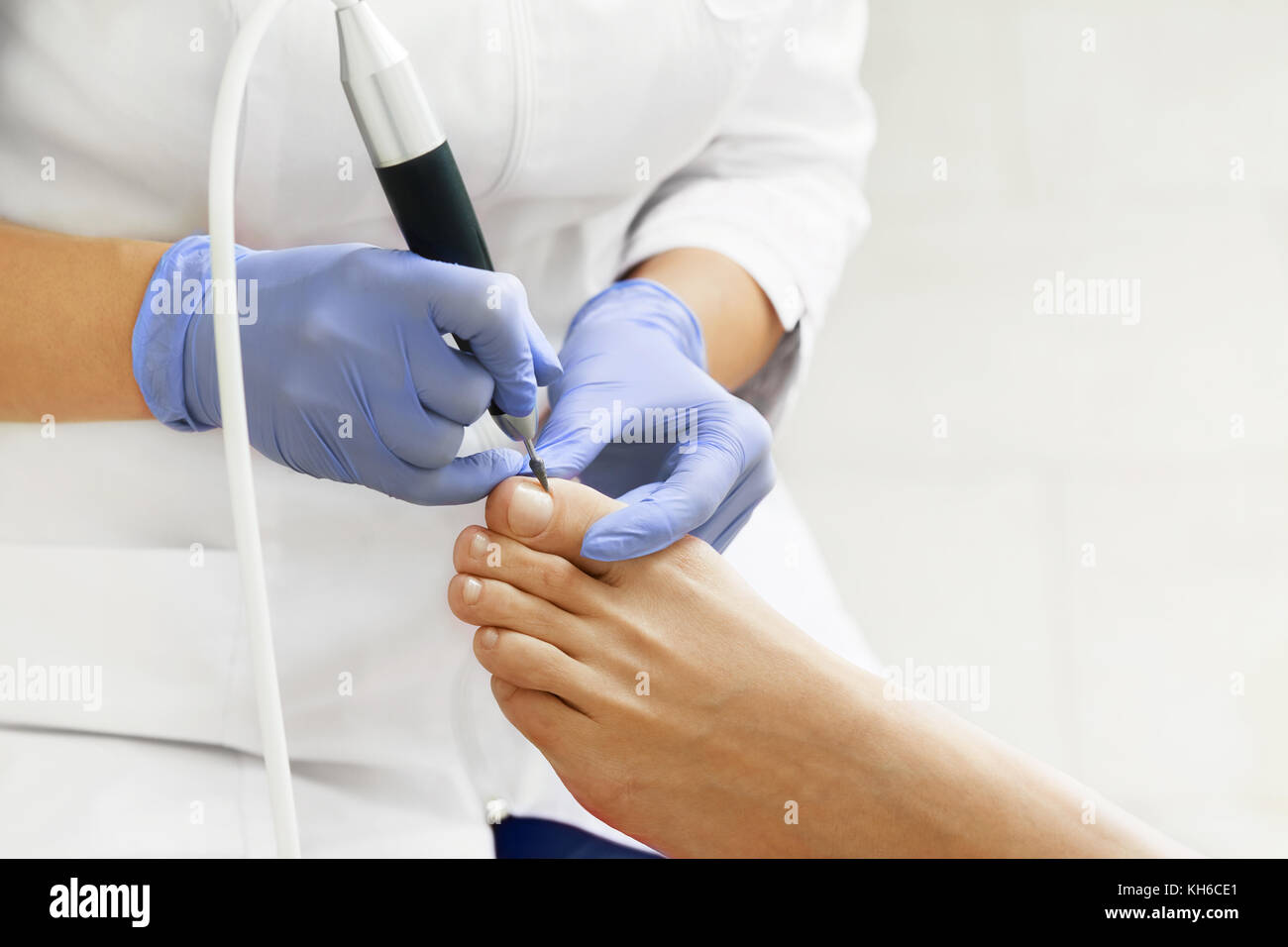 Professional hardware pedicure using electric machine.Patient on ...