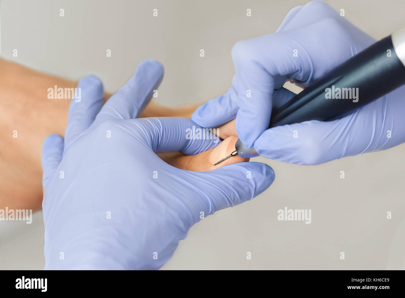 Professional hardware pedicure using electric machine.Patient on ...