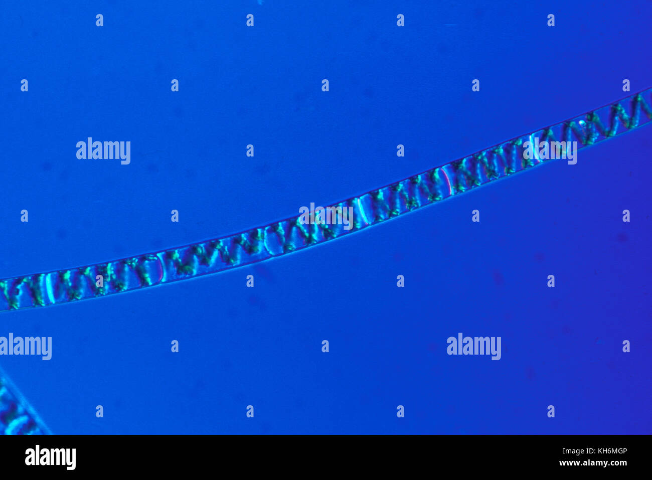 Spirogyra 400x Magnification