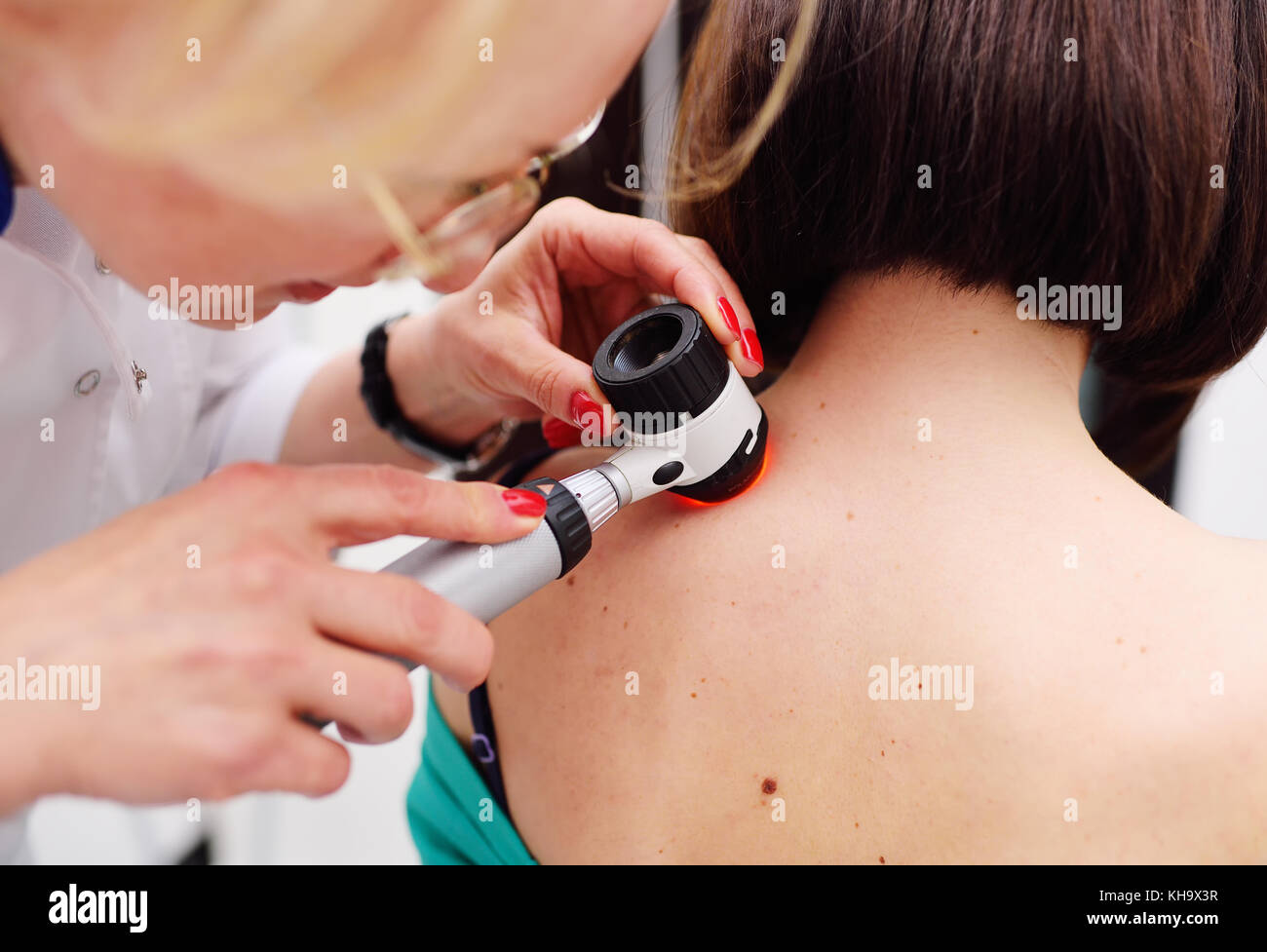 The dermatologist examines the moles or acne of the patient with a ...