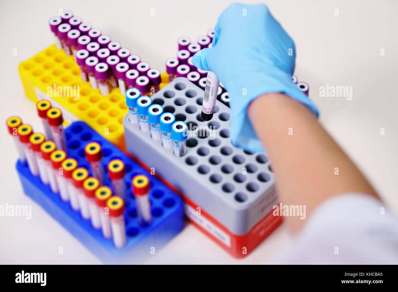 medical test tubes with blood tests Stock Photo - Alamy