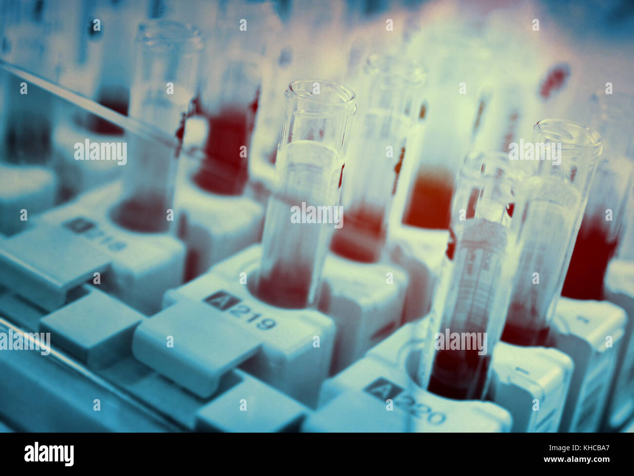 a glass test tube or a flask with blood Stock Photo - Alamy
