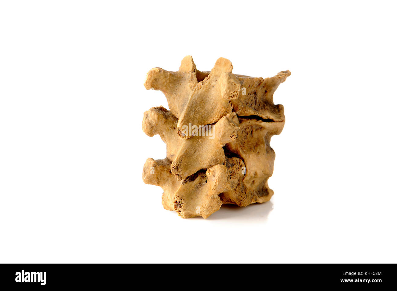 Human spinal cord pelvis model hi-res stock photography and images - Alamy