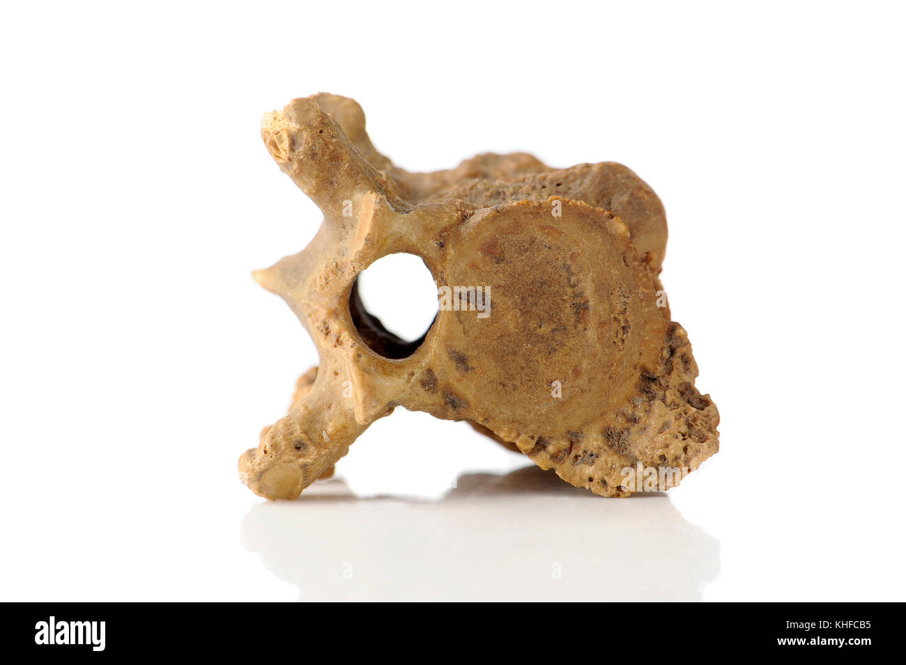 Part of human spine, backbone, isolated on white. Medical example Stock ...