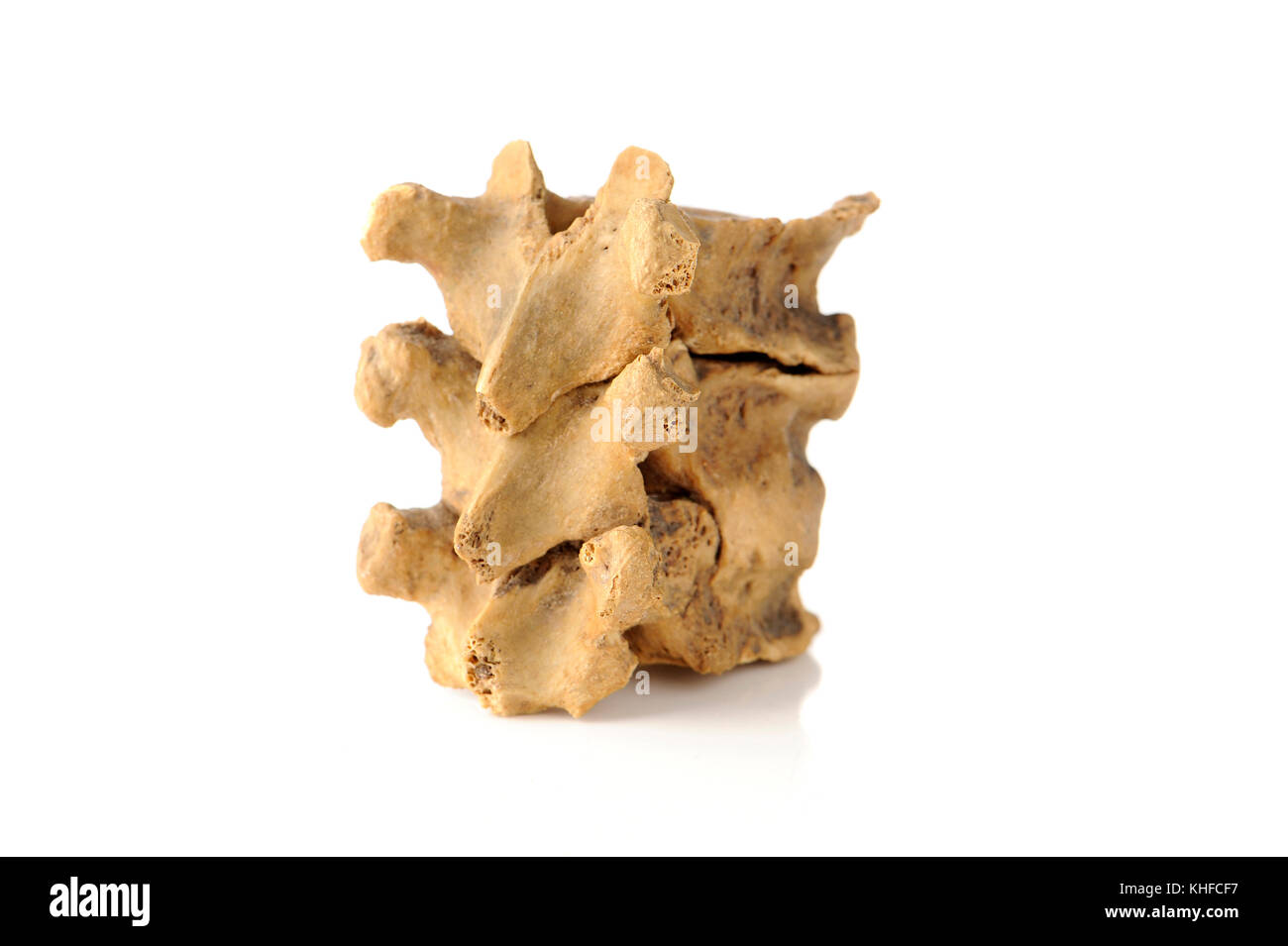 Human spinal cord pelvis model hi-res stock photography and images - Alamy