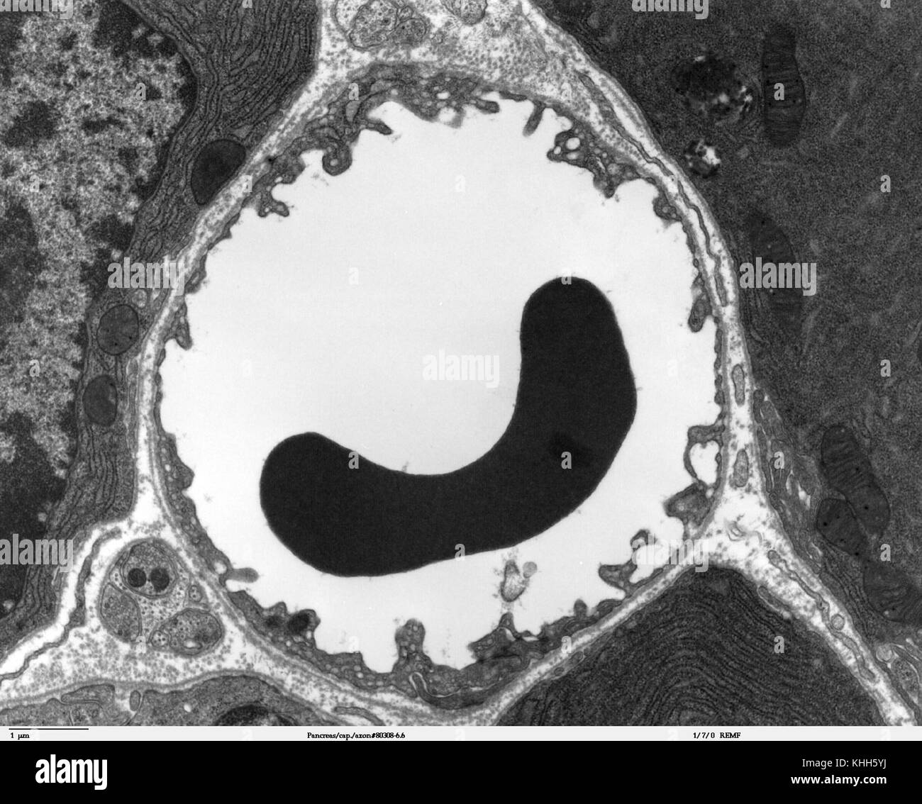 A red blood cell in a capillary, pancreatic tissue - TEM Stock Photo ...