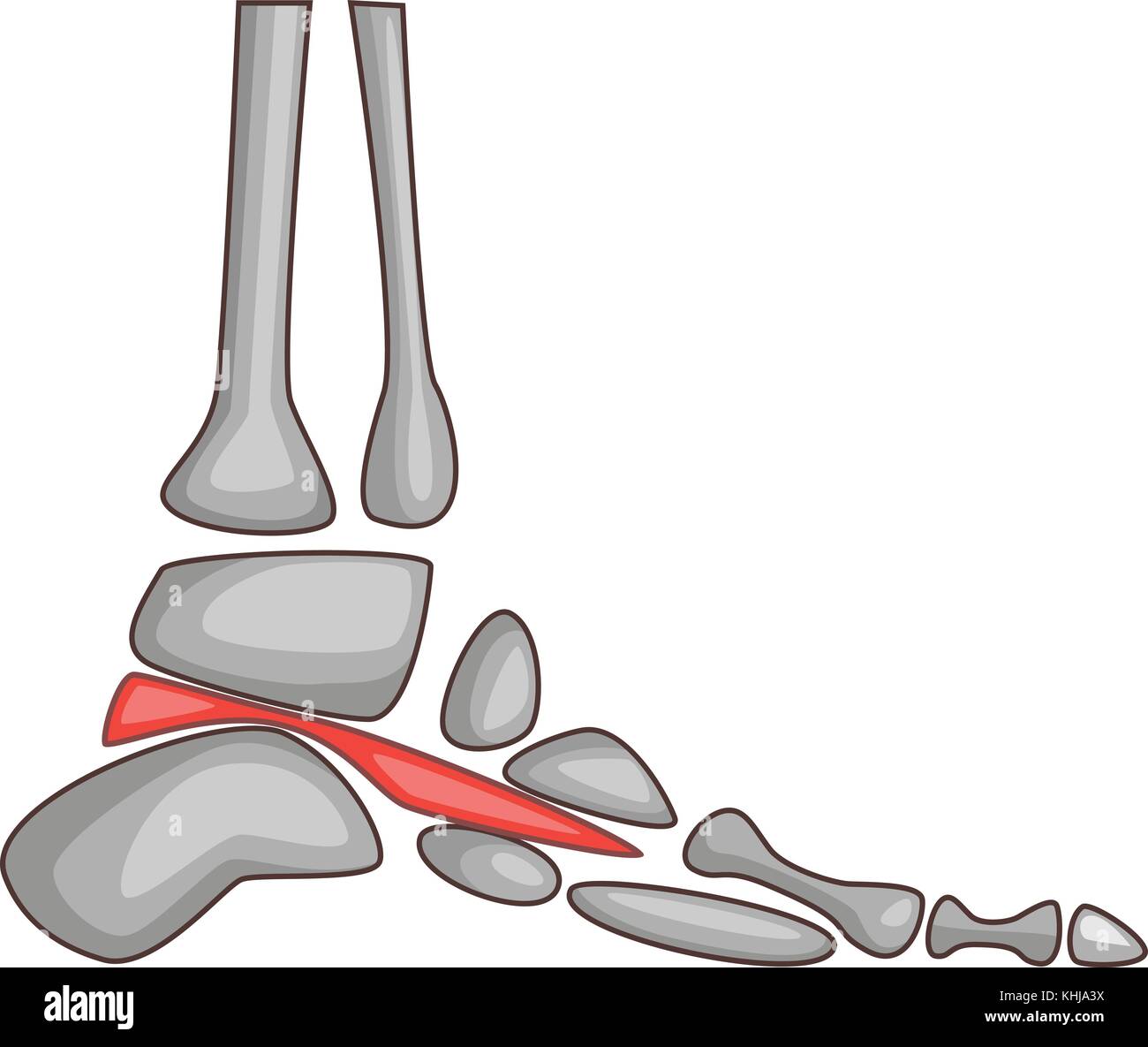 Foot pain icon, cartoon style Stock Vector Image & Art - Alamy