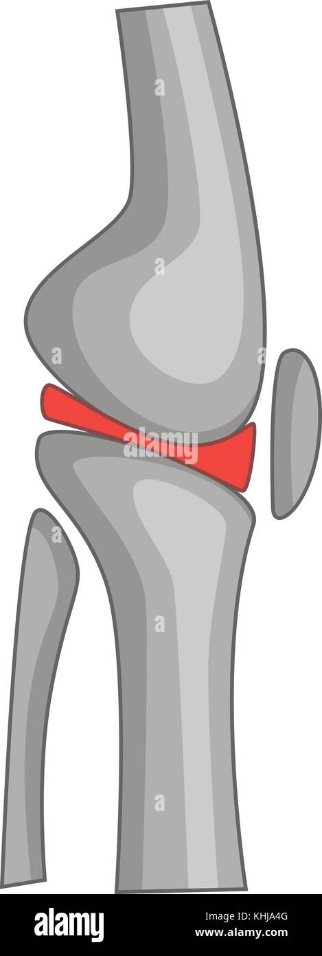 Total artificial knee joint Stock Vector Images - Alamy