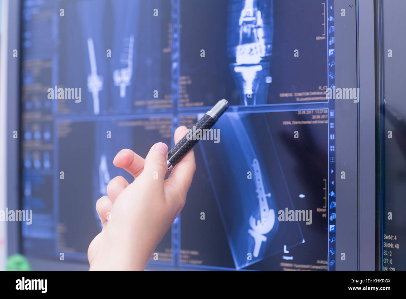 Studying ct scan doctor hi-res stock photography and images - Alamy