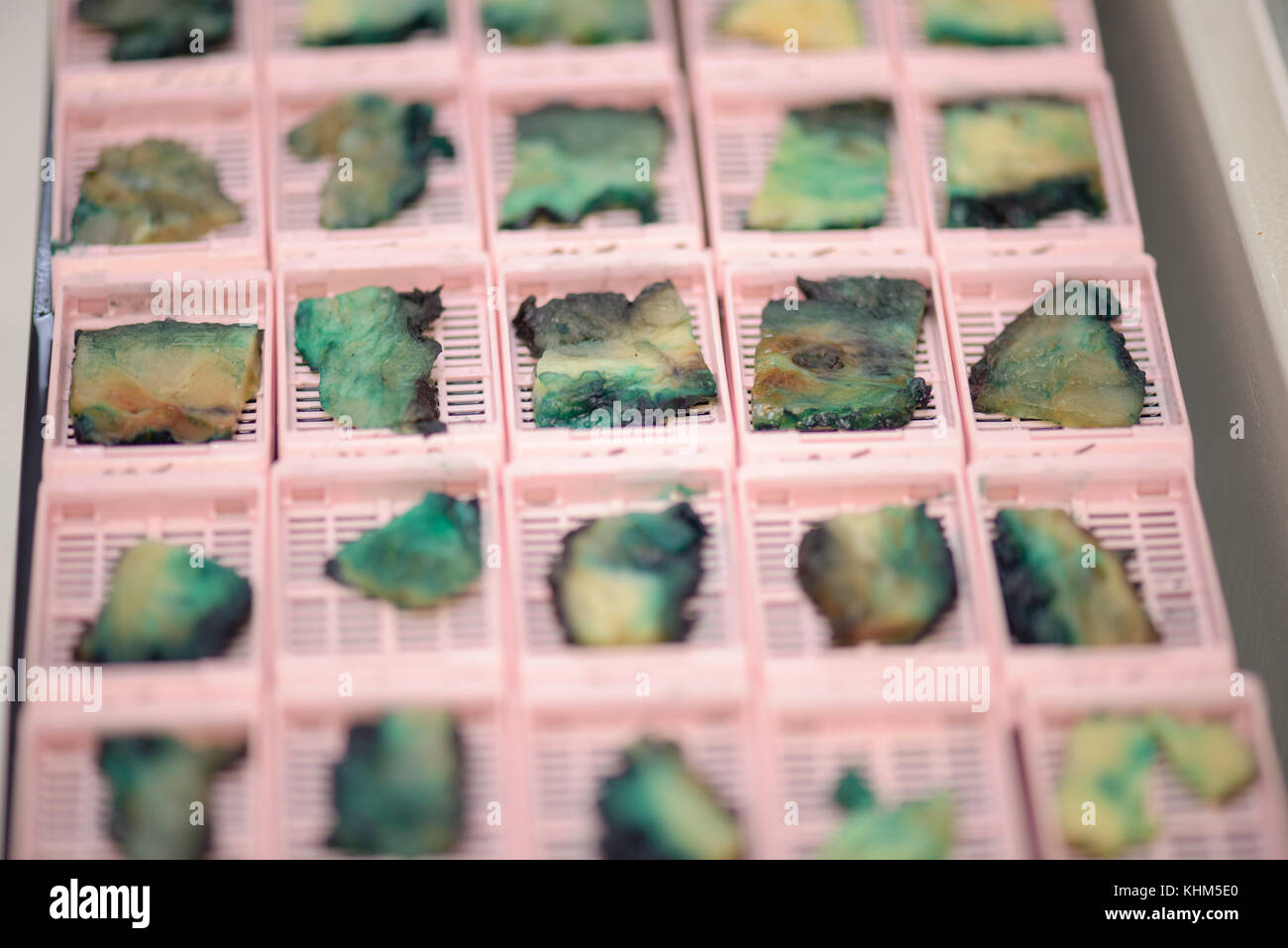 Decaying tissue hi-res stock photography and images - Alamy