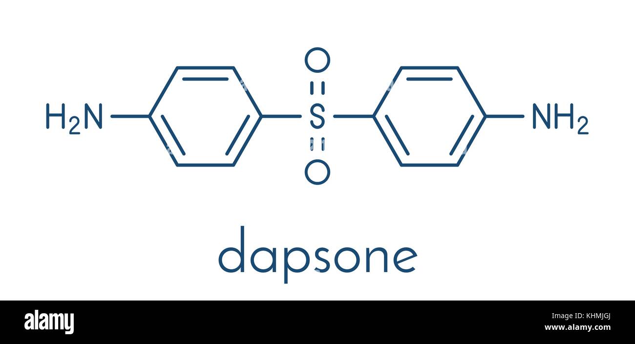 Dapsone antibacterial drug molecule. Skeletal formula Stock Vector ...