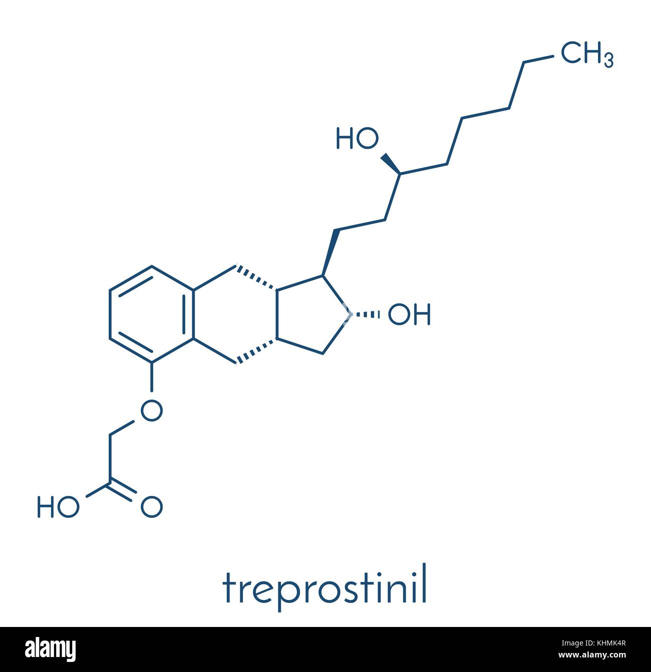 Pulmonary Arterial Hypertension High Resolution Stock Photography and ...