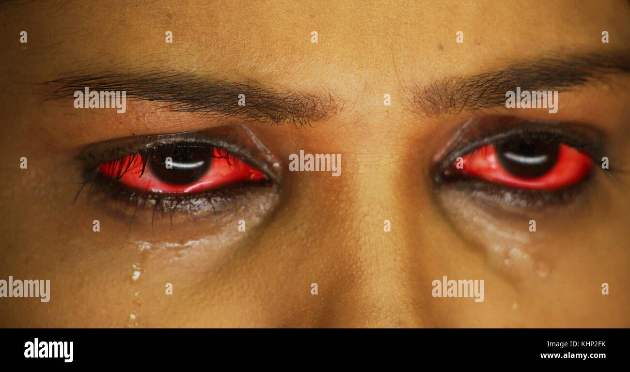 A woman is crying, Red eye of a woman, Woman with eyes wide open Stock ...