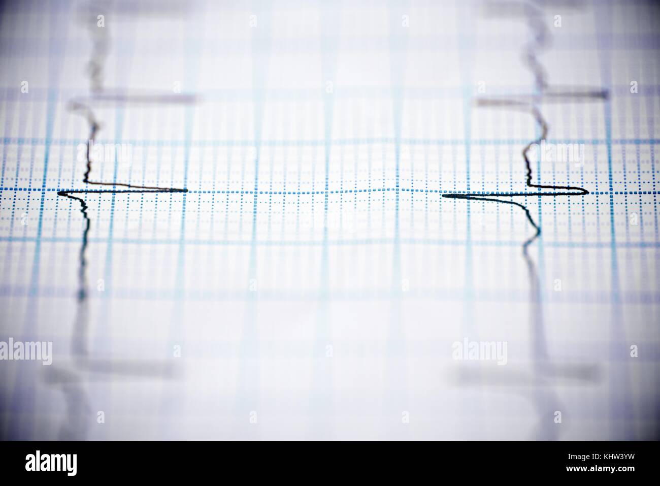 Close up of an electrocardiogram in paper form Stock Photo - Alamy