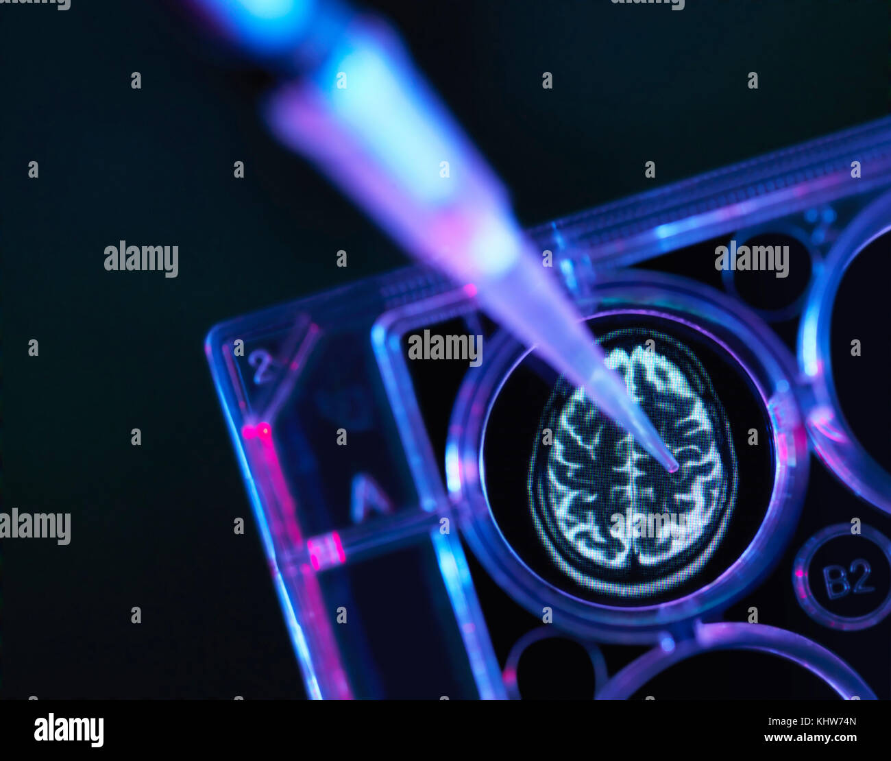 Dementia brain hi-res stock photography and images - Alamy