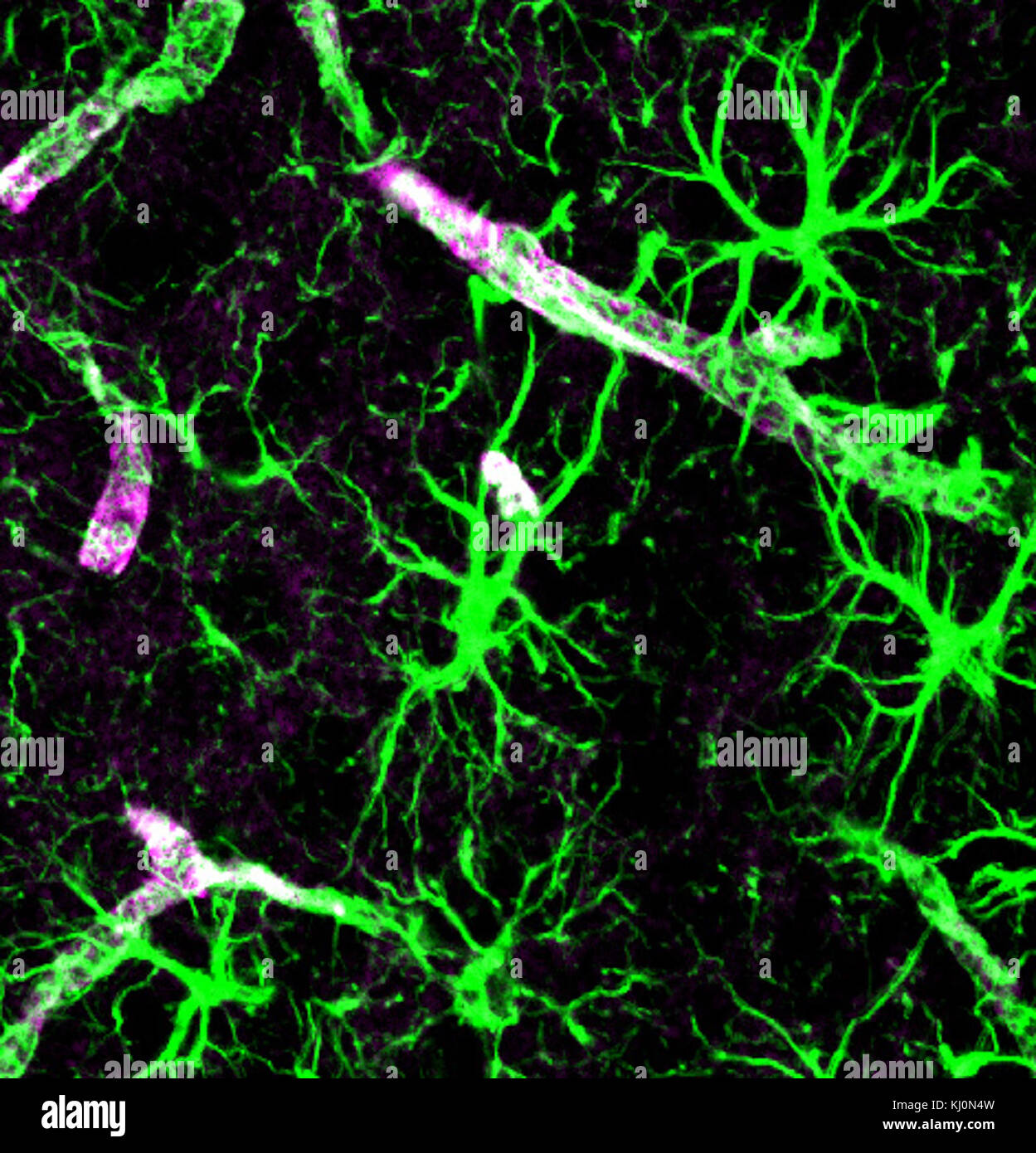 Astrocytes hi-res stock photography and images - Alamy