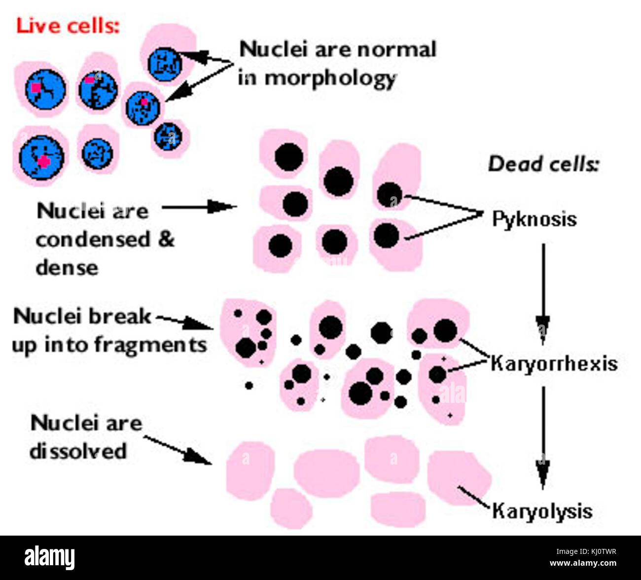 Cellular changes in necrotic cells Stock Photo - Alamy