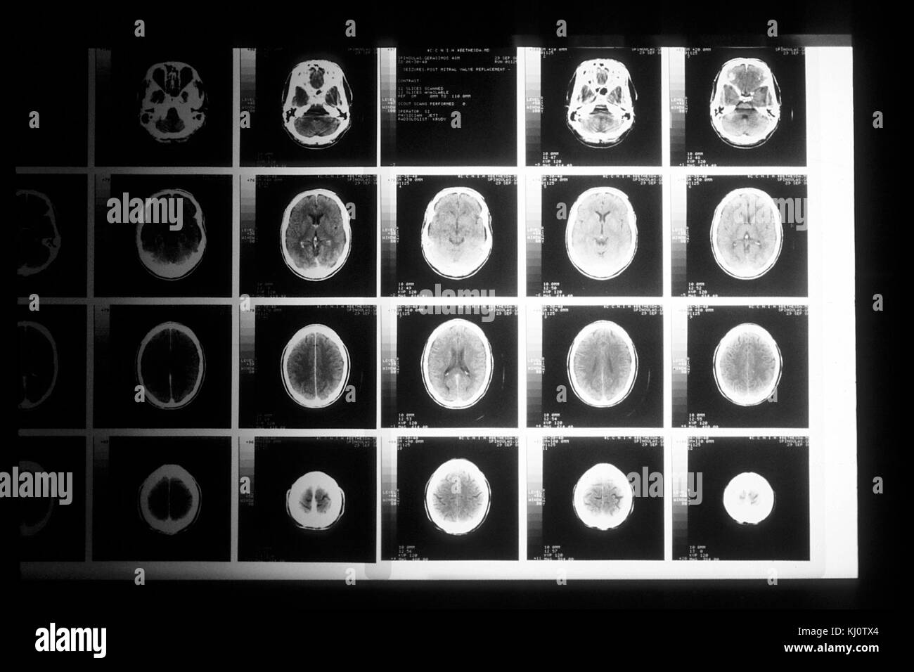 Cat scan (1 Stock Photo - Alamy