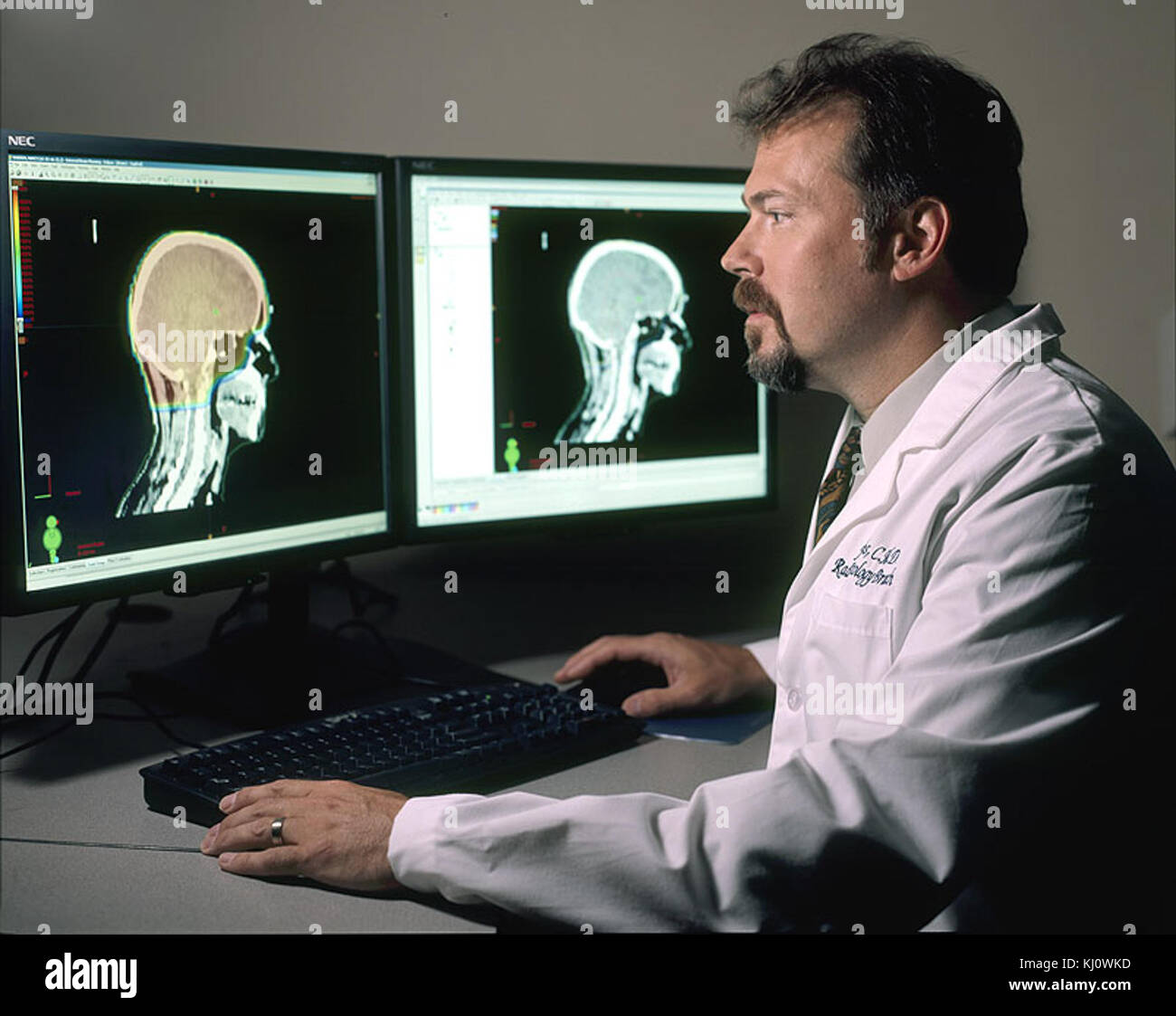 Brain ct scan activity hi-res stock photography and images - Alamy