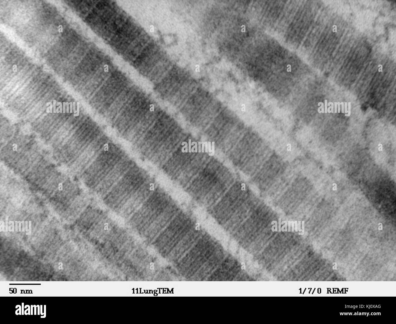 Fibers of Collagen Type I - TEM Stock Photo - Alamy Fibers of Collagen Type I - TEM Stock Photo - Alamy
