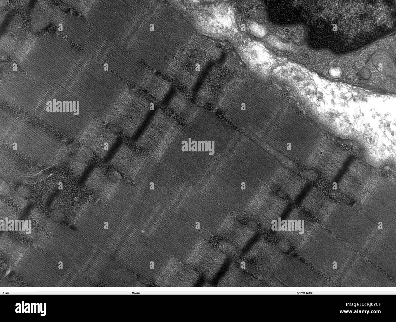 Human skeletal muscle tissue 2 - TEM Stock Photo - Alamy