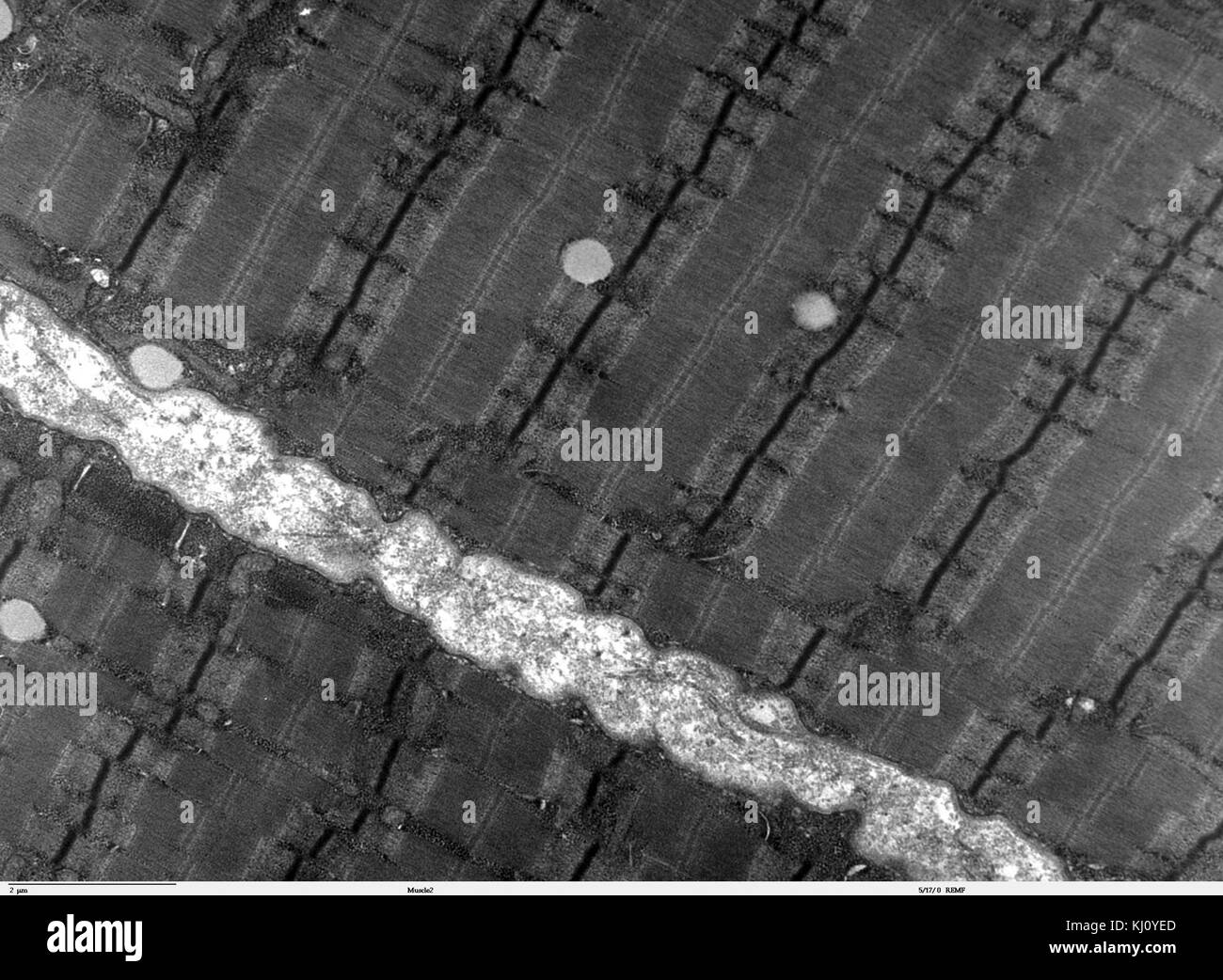 Human skeletal muscle tem hi-res stock photography and images - Alamy