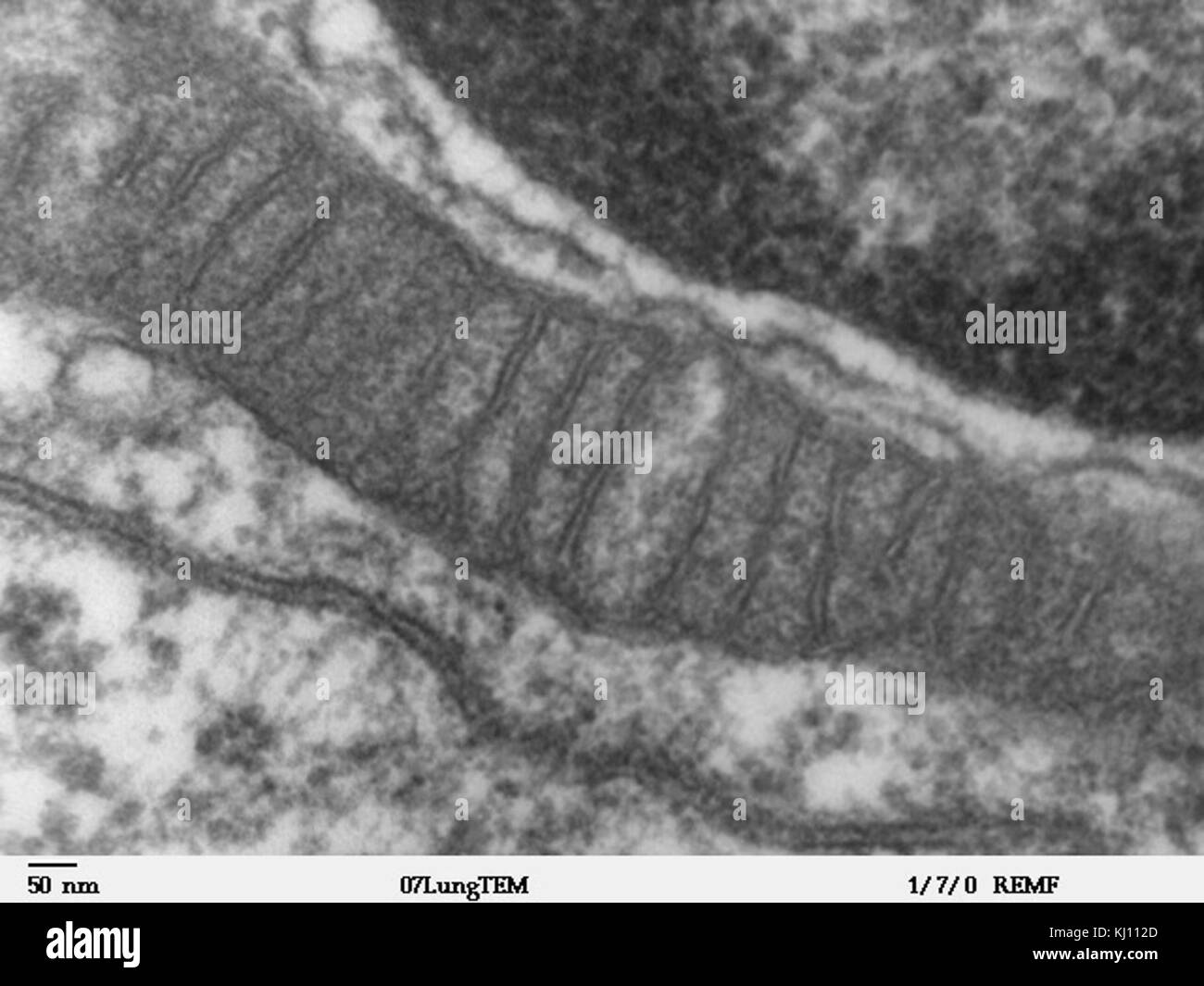 Mitochondria Electron Micrograph Labelled