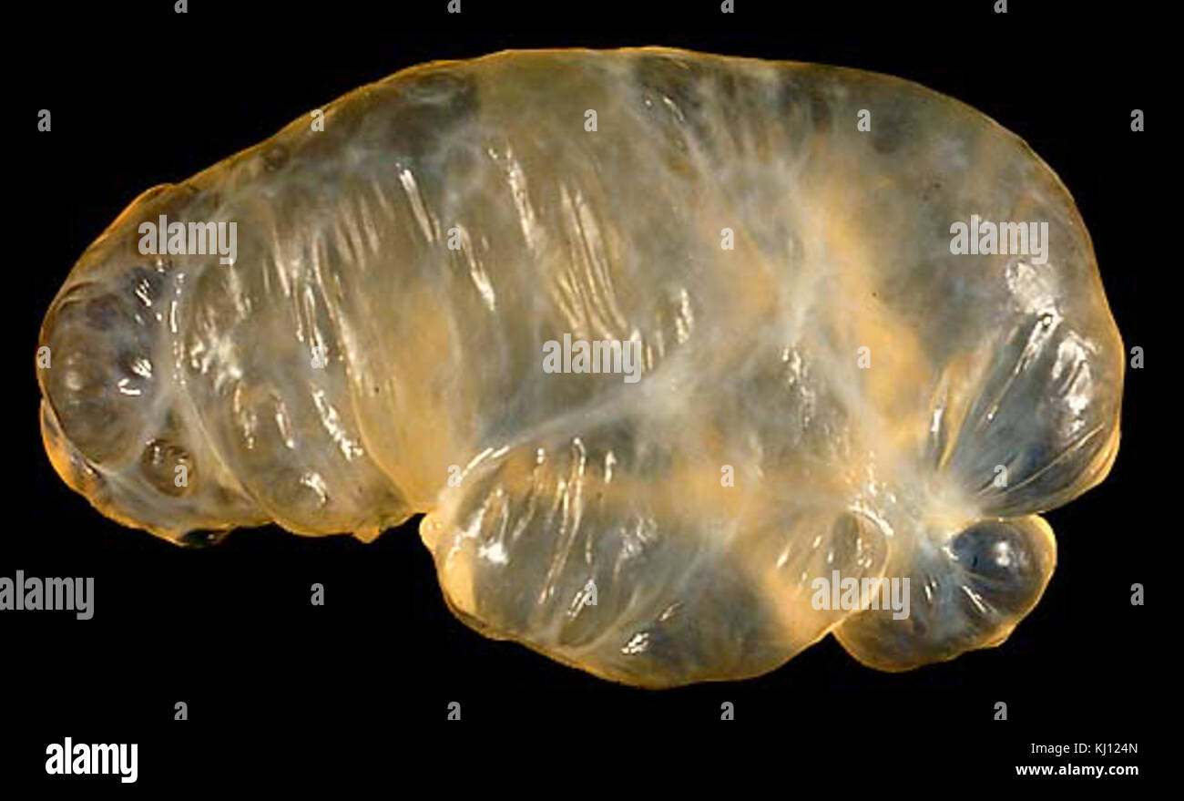 Peritoneal hi-res stock photography and images - Alamy