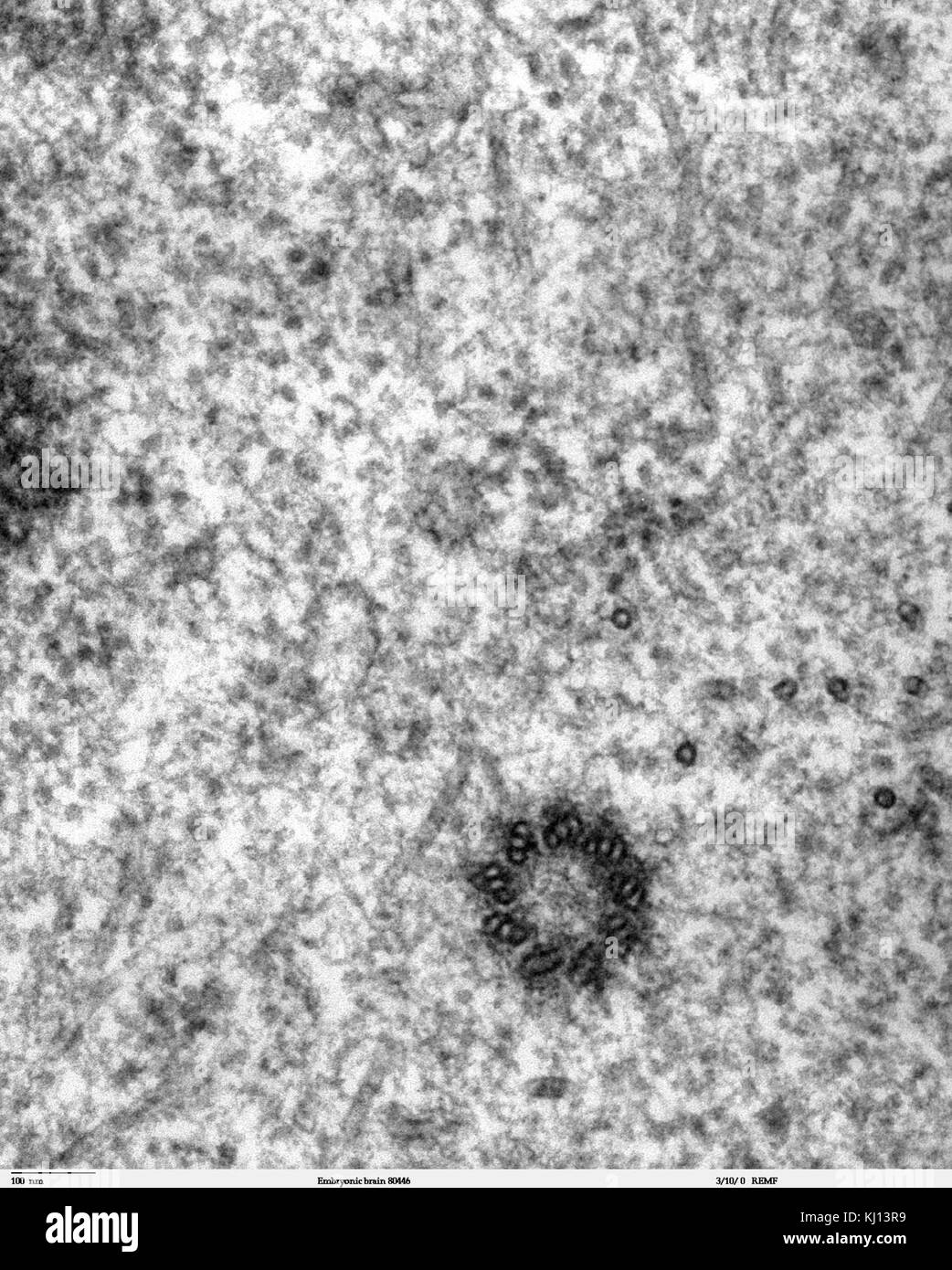 Brain developmental Black and White Stock Photos & Images - Alamy