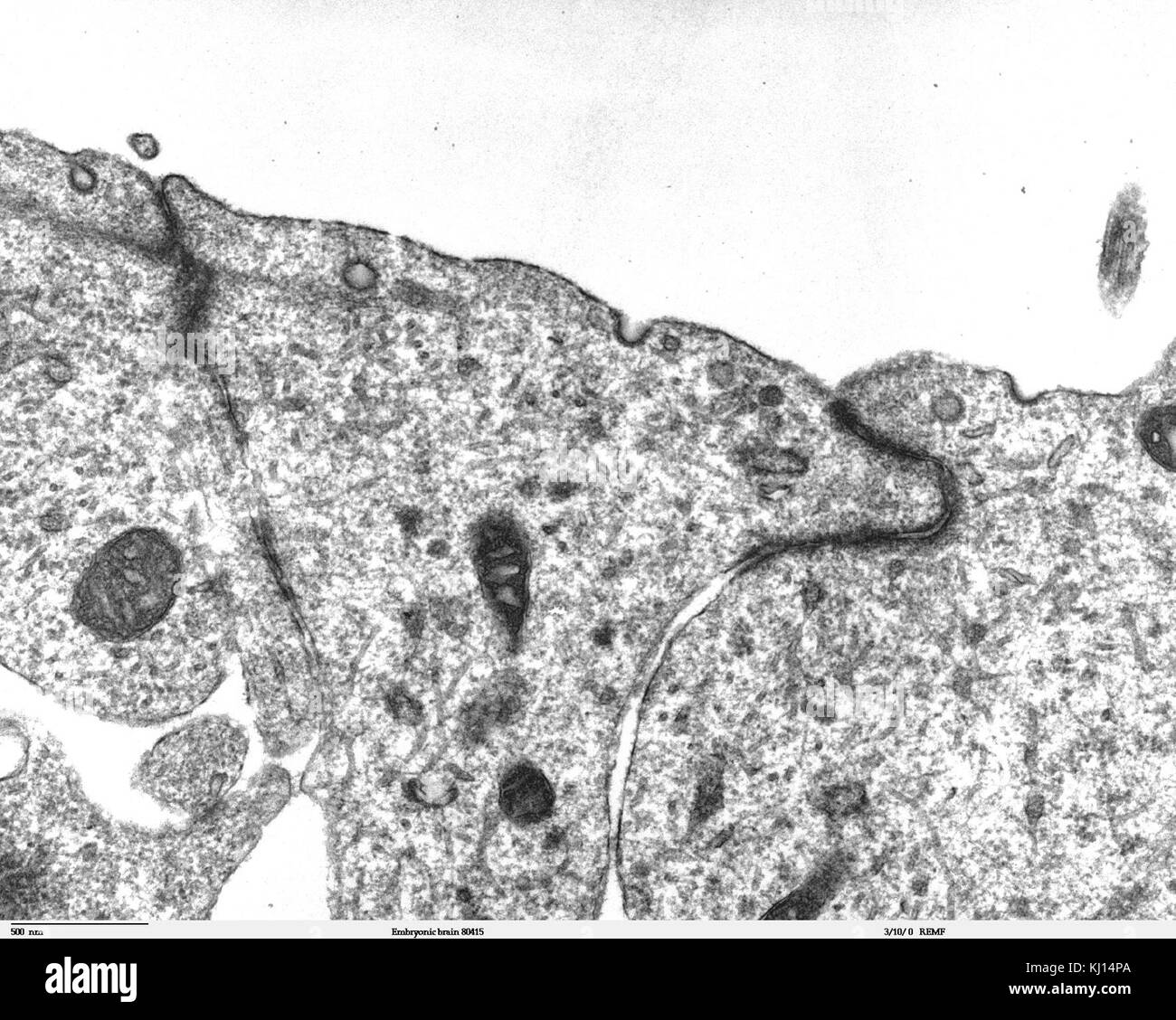 Unctional complex and pinocytotic vesicles - embryonic brain - TEM ...