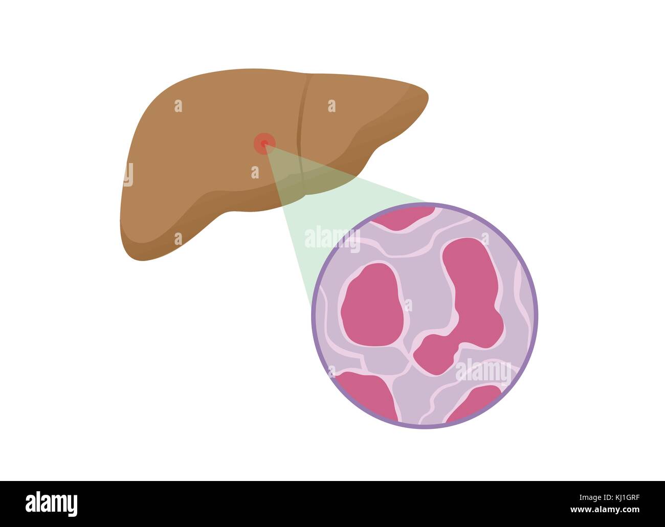 Problem showing Stock Vector Images - Alamy