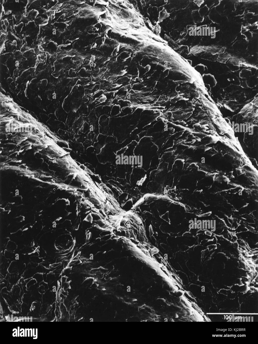 Skin surface (human Stock Photo - Alamy