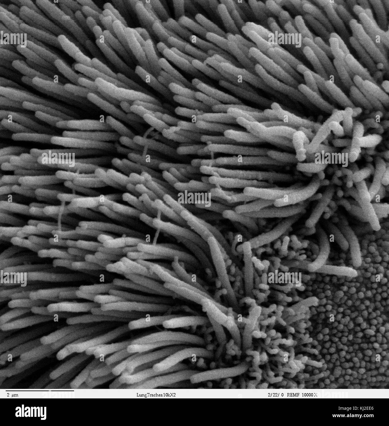 Bronchiolar epithelium 4 - SEM Stock Photo - Alamy