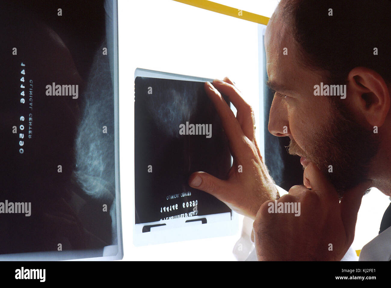 Doctor viewing mammogram Stock Photo - Alamy