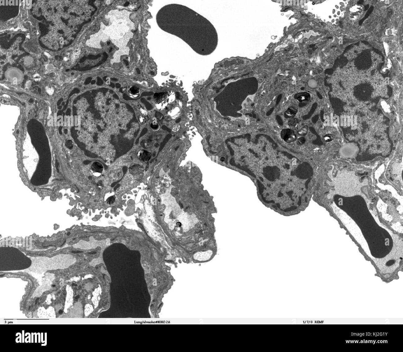 Alveolar sac hi-res stock photography and images - Alamy