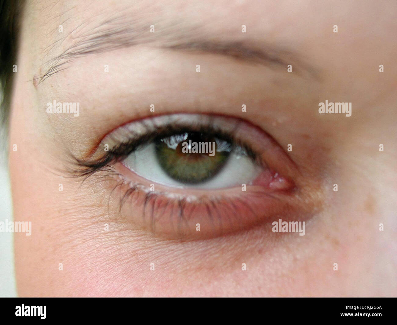 Ocular surface of eye hi-res stock photography and images - Alamy