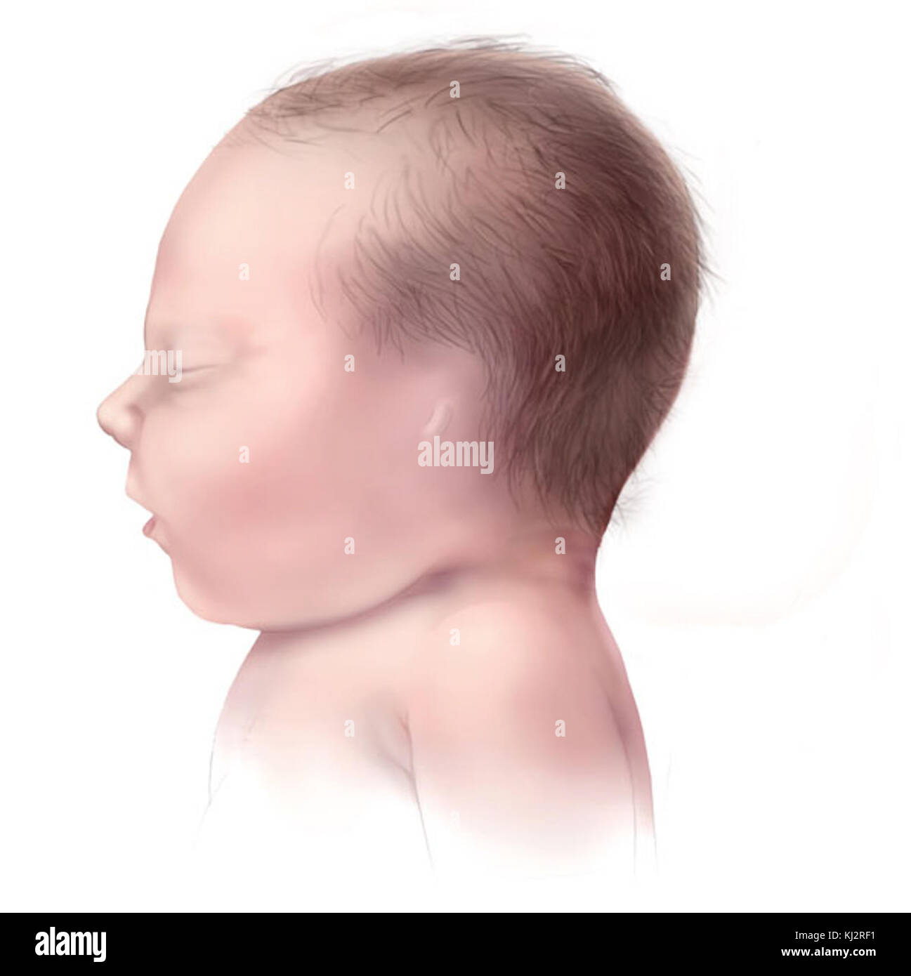 Anotia hi-res stock photography and images - Alamy