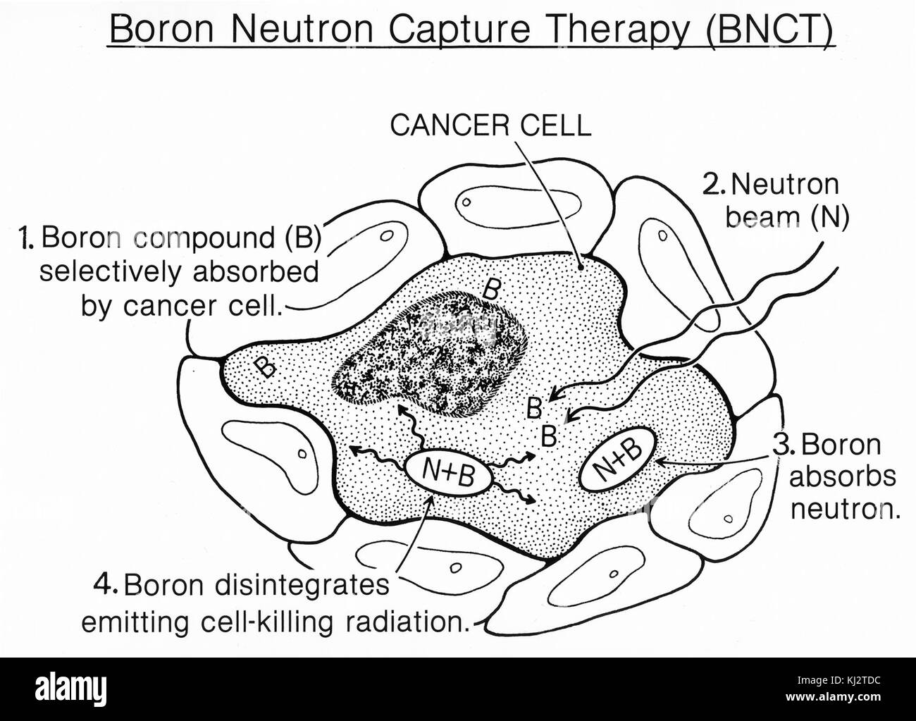 Boron neutron capture therapy (bnct) illustration Stock Photo - Alamy